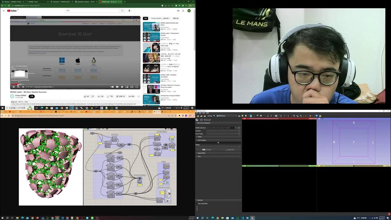Preparing My Research ( 3D Unet Model) - YouTube