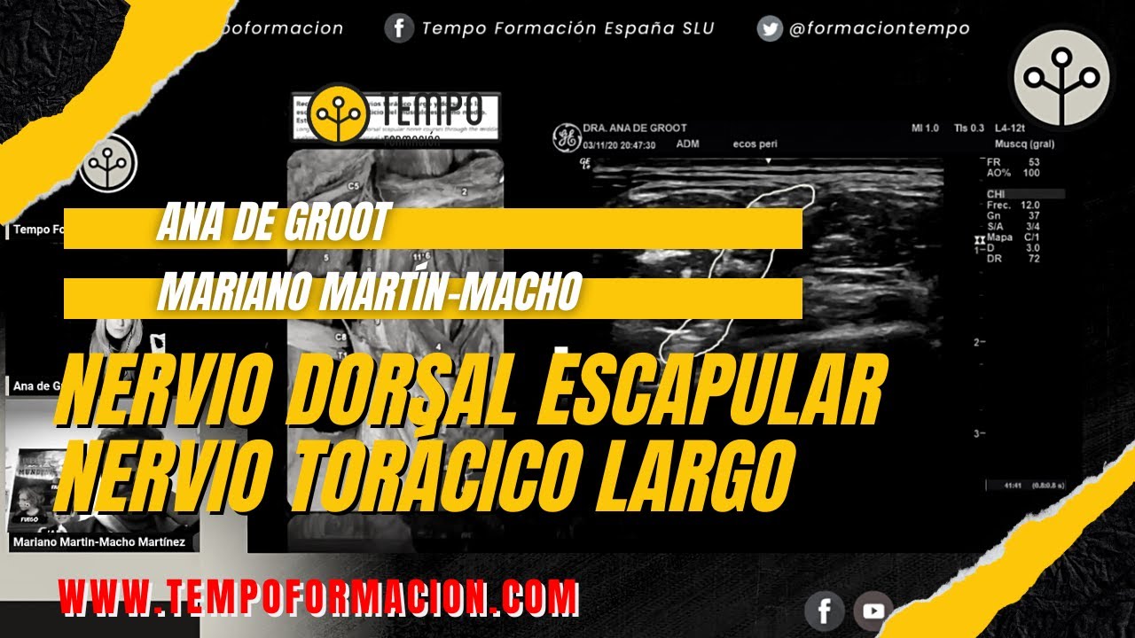 Nervio dorsal escapular y nervio torácico largo con Ana de Groot y ...