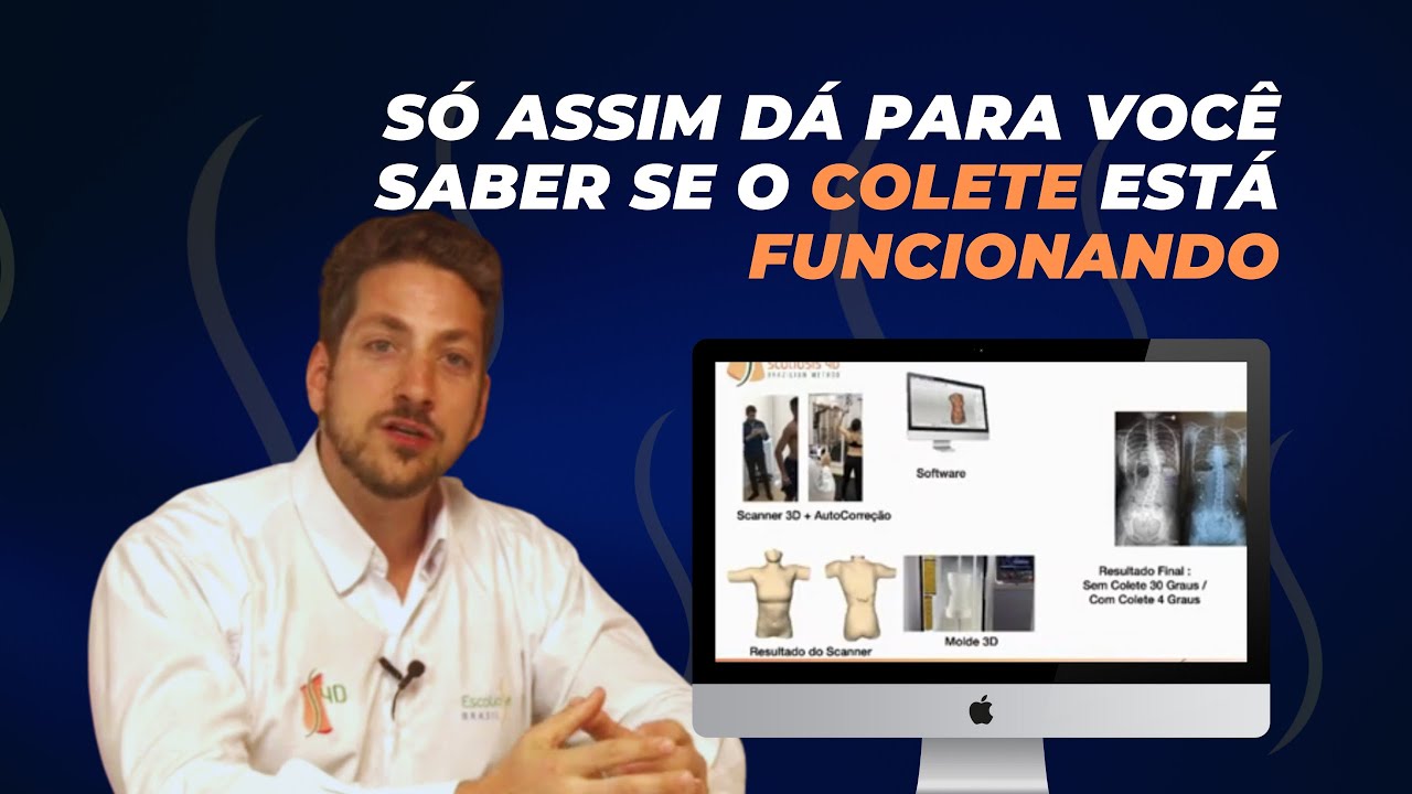 ESSE É O COLETE MAIS INDICADO PARA TRATAR A ESCOLIOSE (CONHEÇA O COLETE ...
