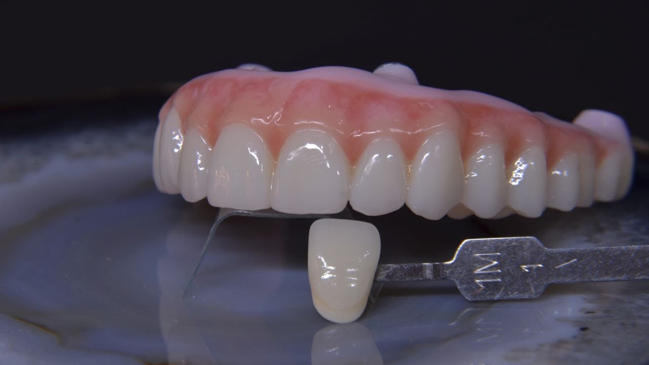 Al on4. Natural translucency of Full contour Zirconia - YouTube