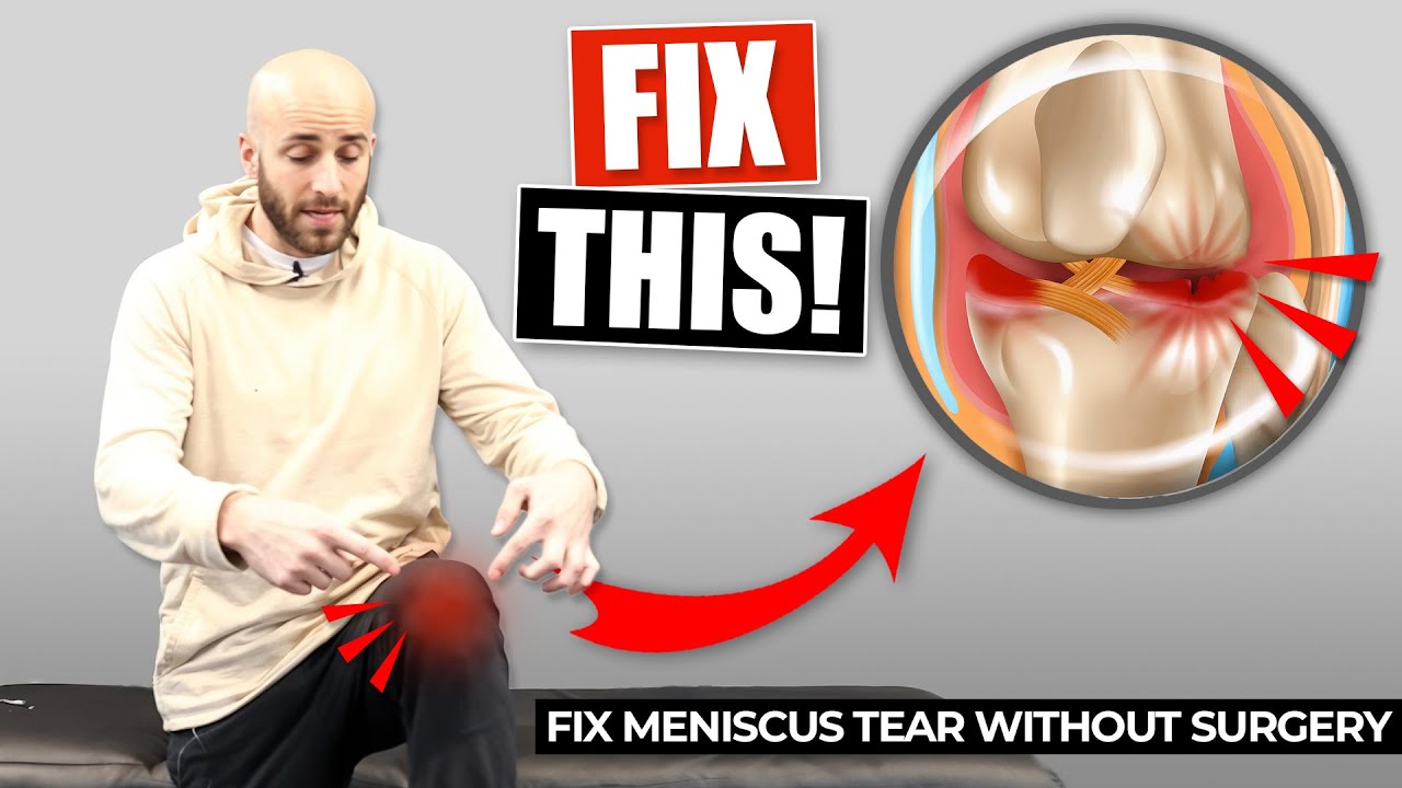 FIX MENISCUS TEAR WITHOUT SURGERY (VERY EFFECTIVE EXERCISES!) - YouTube