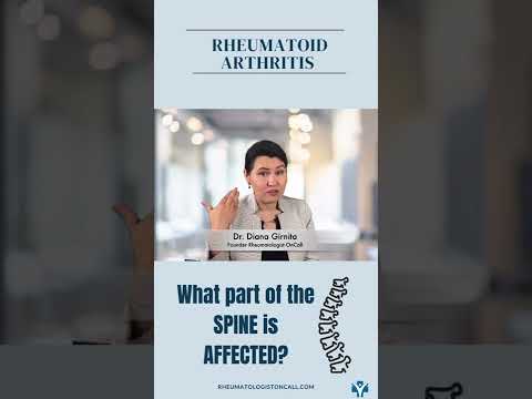 Does Arthritis Cause Weakness In The Neck