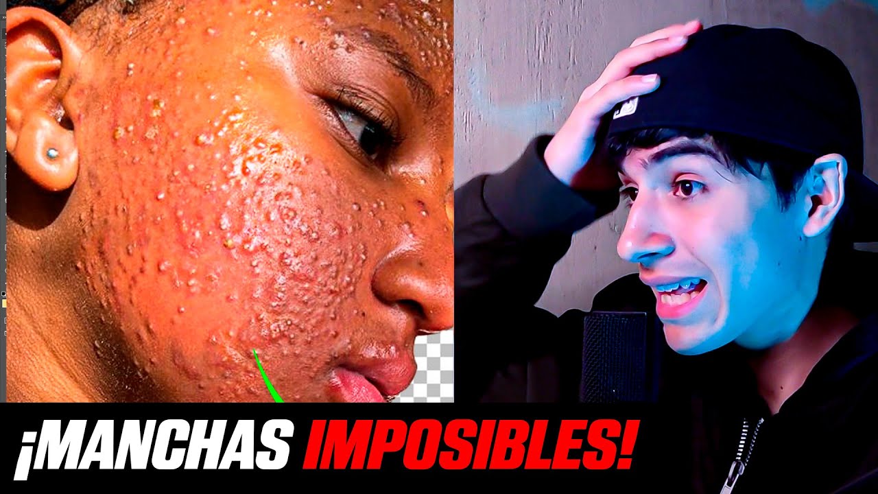 COMO QUITAR ACNE MOD PRO | Photoshop Tutorial - YouTube