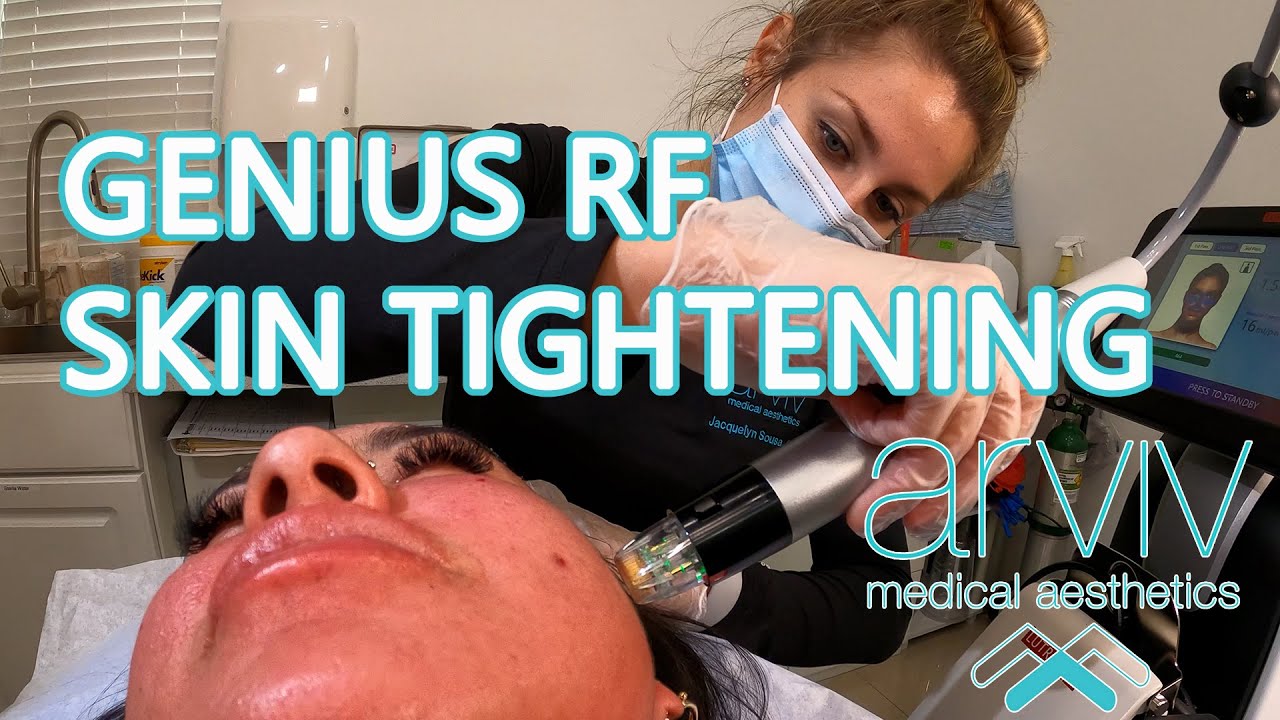 Genius RF Skin Tightening - Dr Tali Arviv - Arviv Aesthetics - YouTube
