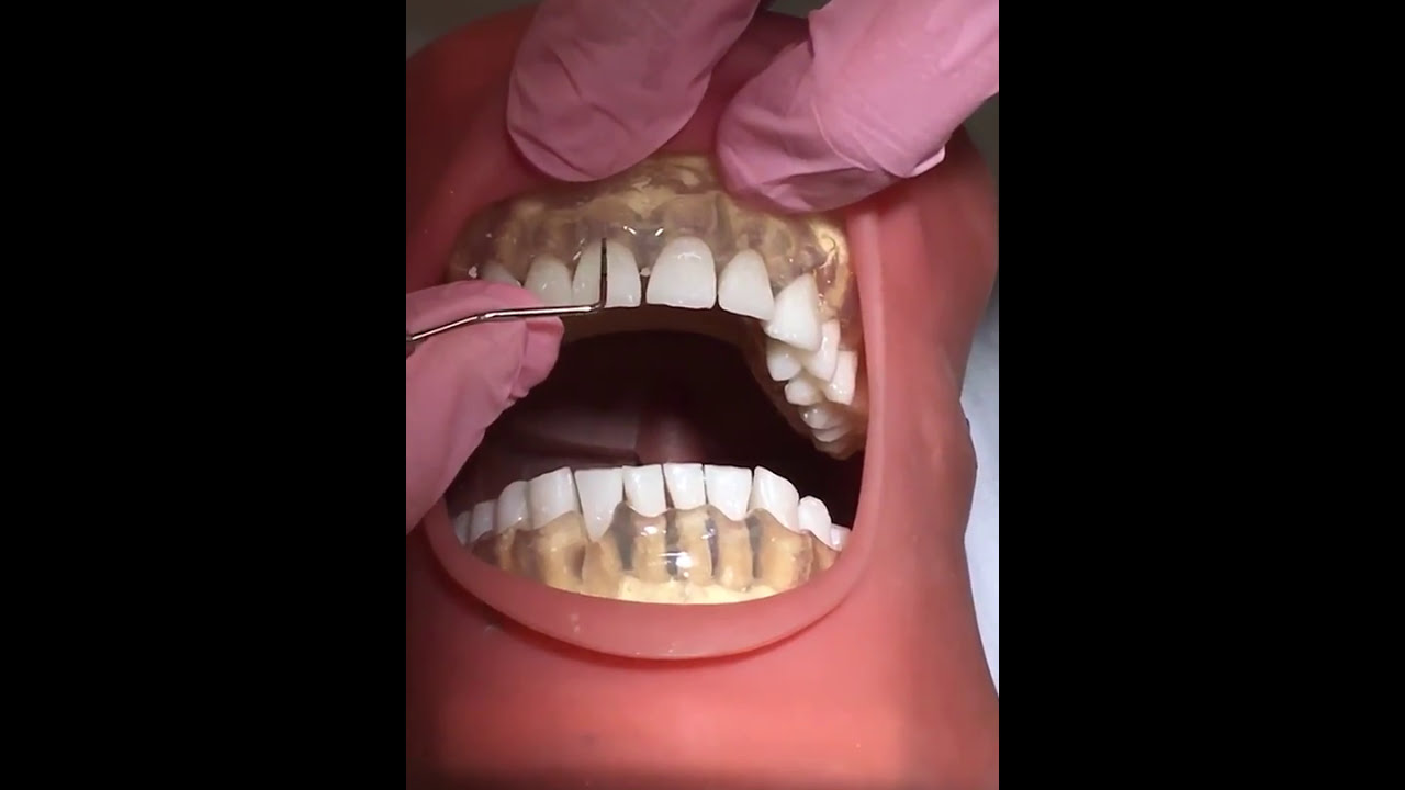 Probing Technique Video - YouTube