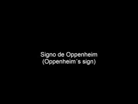 signo de babinski y sucedaneos (Neurona motora superior: Gordon ...