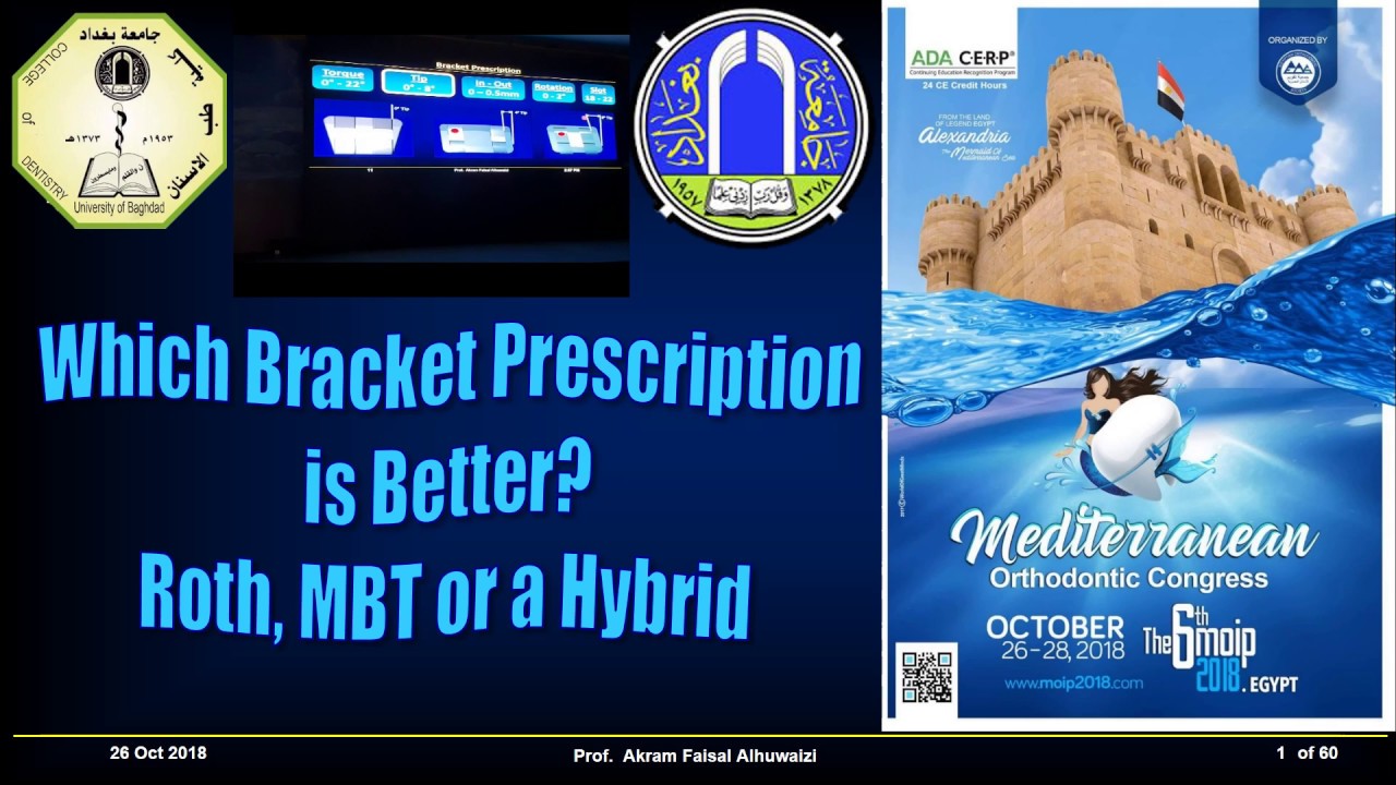 Which bracket prescription is better, MBT, Roth or a Hybrid? - YouTube