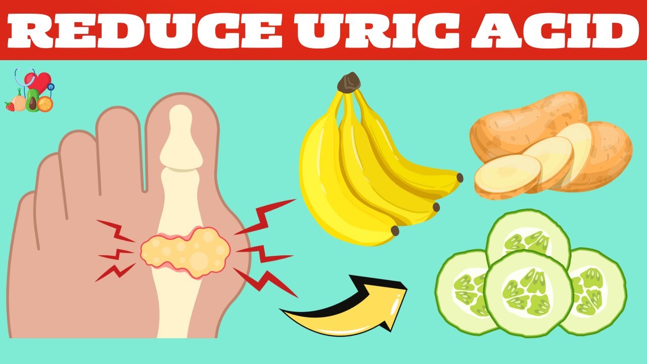 These 12 Foods Lower Uric Acid Naturally Youtube