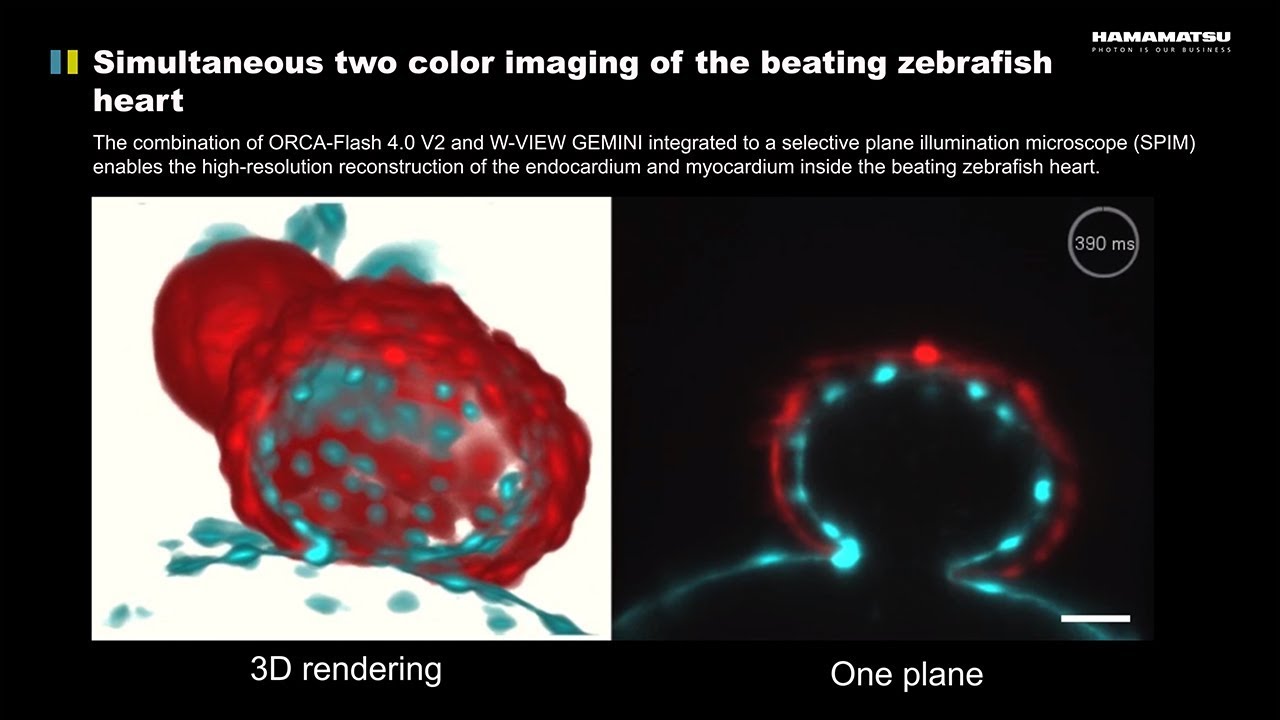Simultaneous two color imaging of the beating zebrafish heart - YouTube