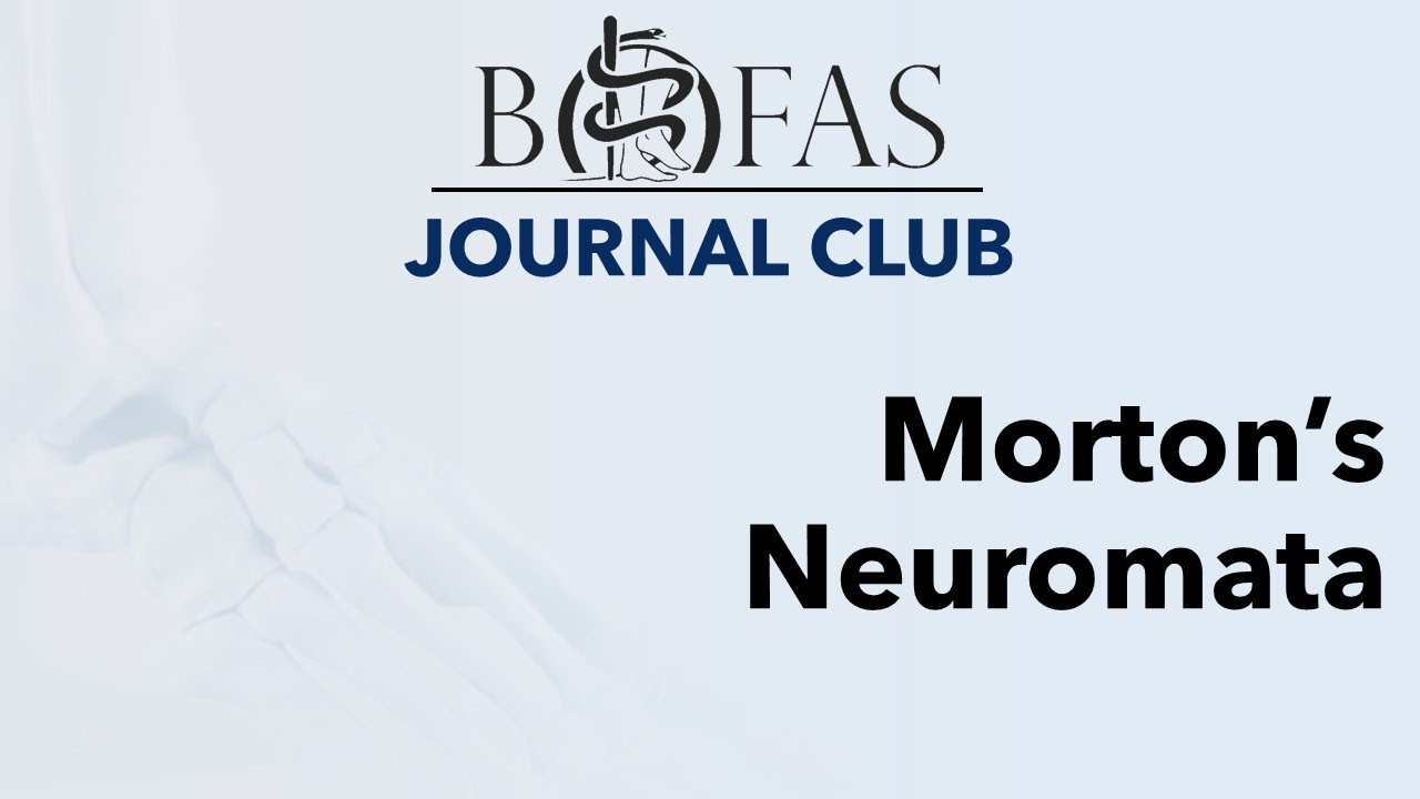 Morton's Neuromata - BOFAS Journal Club - YouTube