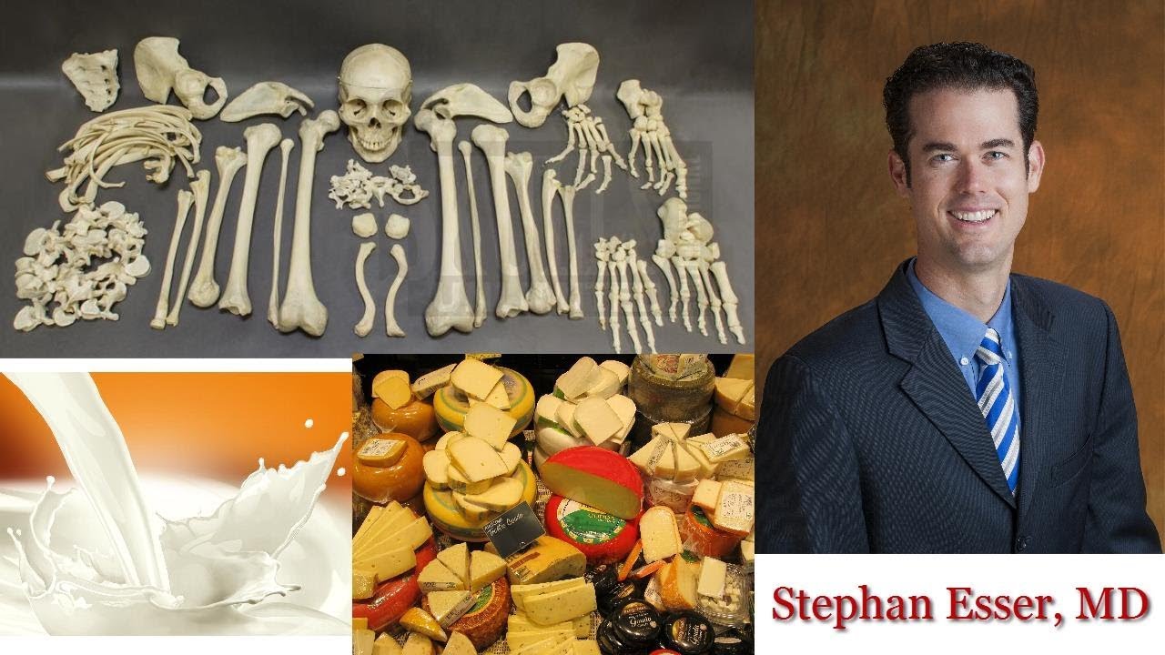 Is Dairy Good for Strong Bones? | Stephan Esser, MD - YouTube