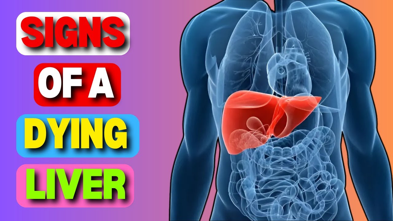 10 Signs of a Dying Liver (End Stage Liver Disease) - YouTube