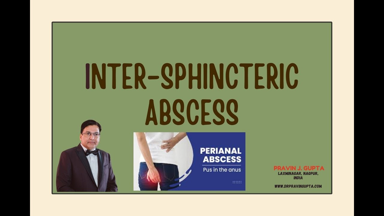 MANAGING AN INTERSPHINCTERIC ABSCESS - YouTube