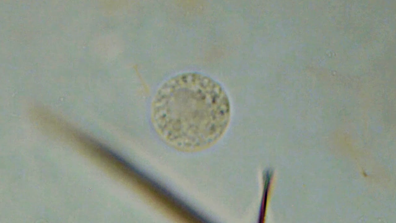 Pyroptosis of Neutrophils ---- a Cell under Microscope Blows Up! - YouTube