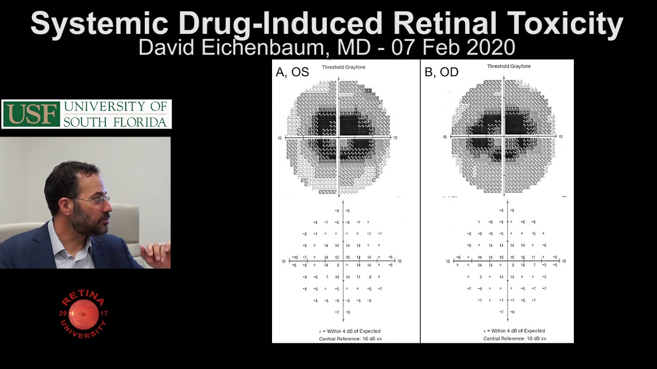 Systemic-Drug Induced Retinal Toxicity - David Eichenbaum, MD ...