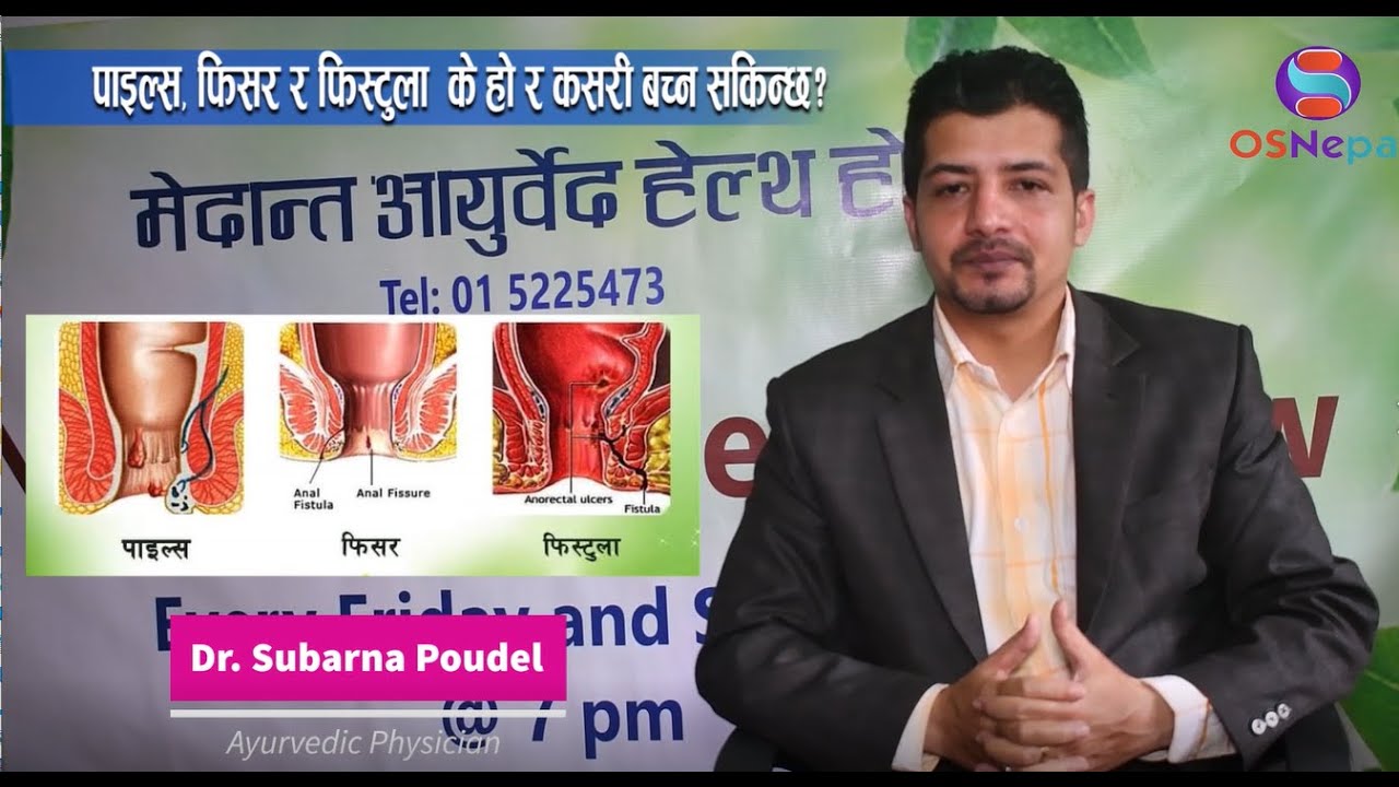 पाइल्स, फिसर र फिस्टुला के हो र कसरी बच्न सकिन्छ? ll Dr. Subarna Poudel - YouTube