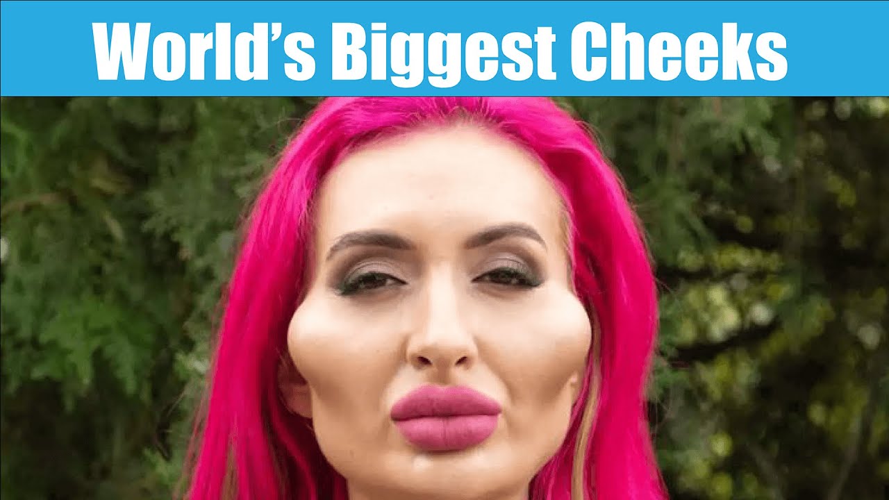 Model With 'World's Biggest Cheeks' Looks so different - YouTube