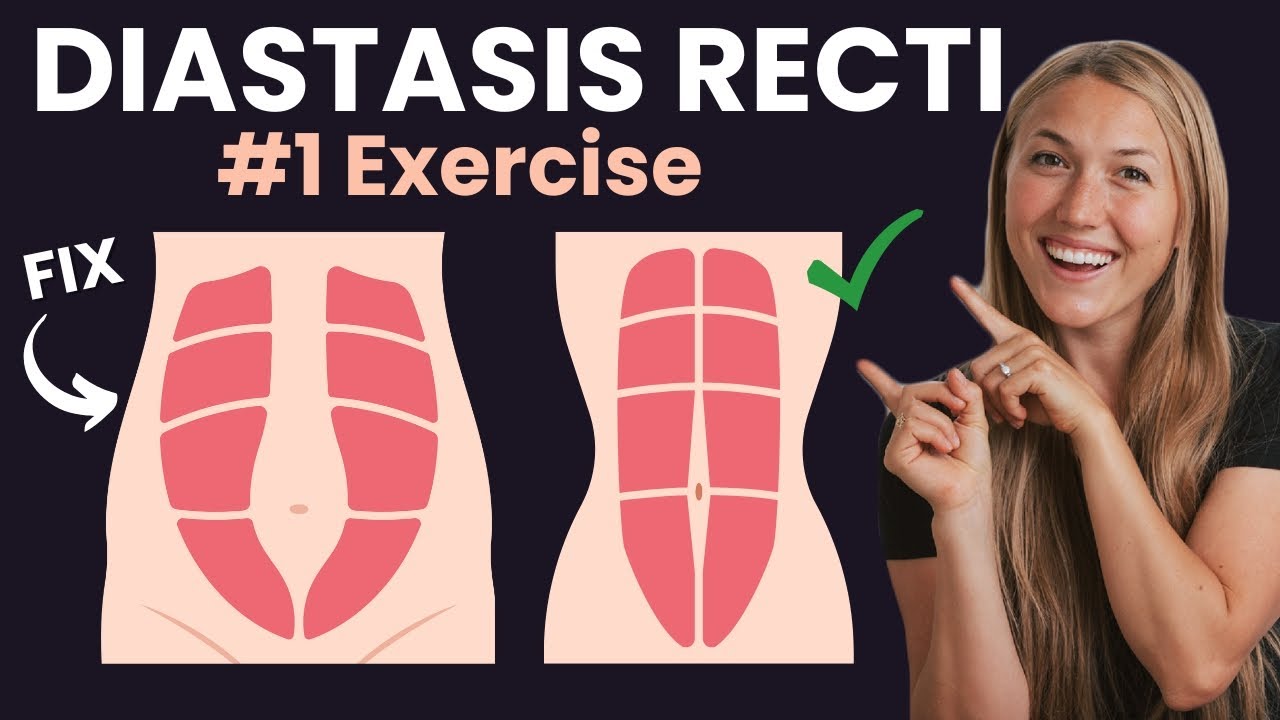 BEST Diastasis Recti Exercise To Strengthen Core - Postpartum Fitness ...