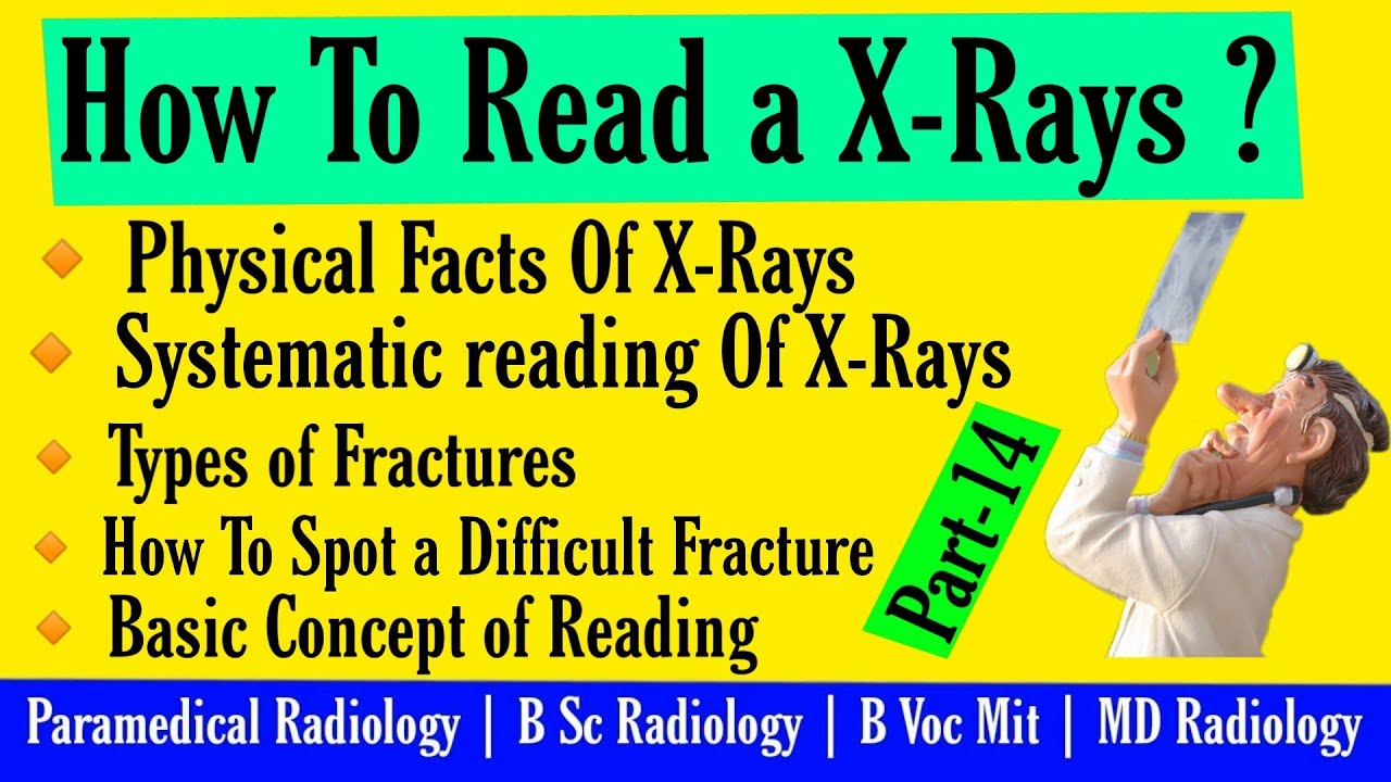 How To Read X Ray • X Ray Kaise Pade | Radiology Classes in Hindi | Dr. Vivek ChhimPa - YouTube
