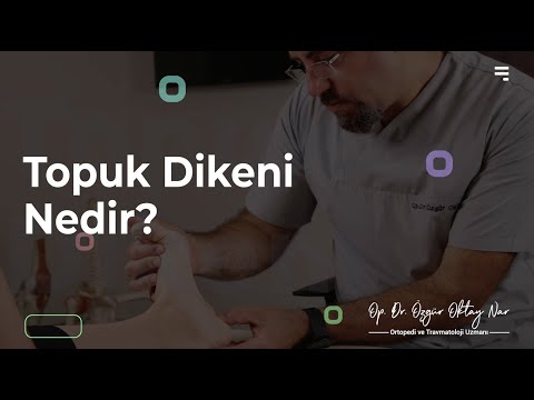 Topuk Dikeni Nedir? - Ortopedi ve Travmatoloji Uzmanı Op. Dr. Özgür Oktay Nar