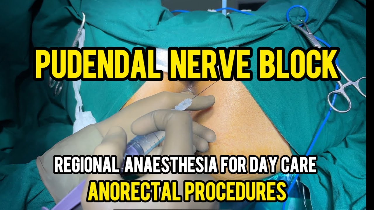 PUDENDAL NERVE BLOCK | Regional Anaesthesia Nerve Block | DAY CARE Surgery Anaesthesia - YouTube