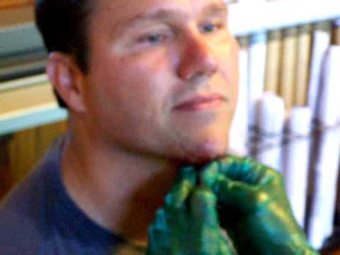 Busted chin.......face meets motor - YouTube