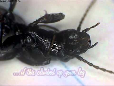 Under The Microscope - The Nightcrawler - YouTube