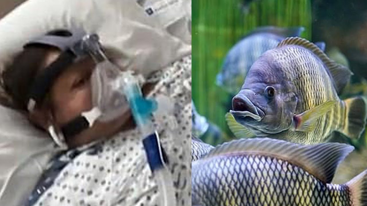 Mum, 40, loses all four limbs after eating undercooked fish for dinner ...