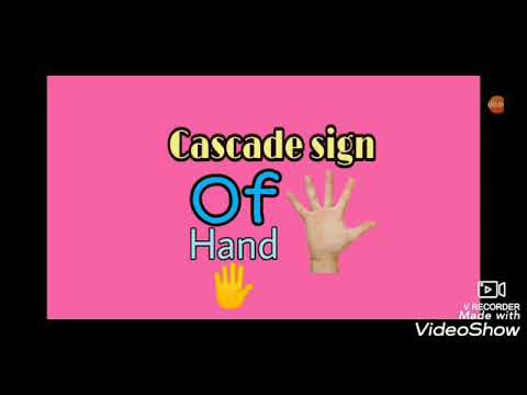Cascade sign Of Hand || cascade sign in Orthopaedics || examination of ...