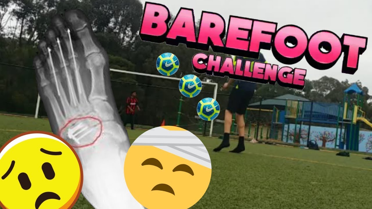 HE BROKE HIS FOOT! | Epic Barefoot Challenge - YouTube