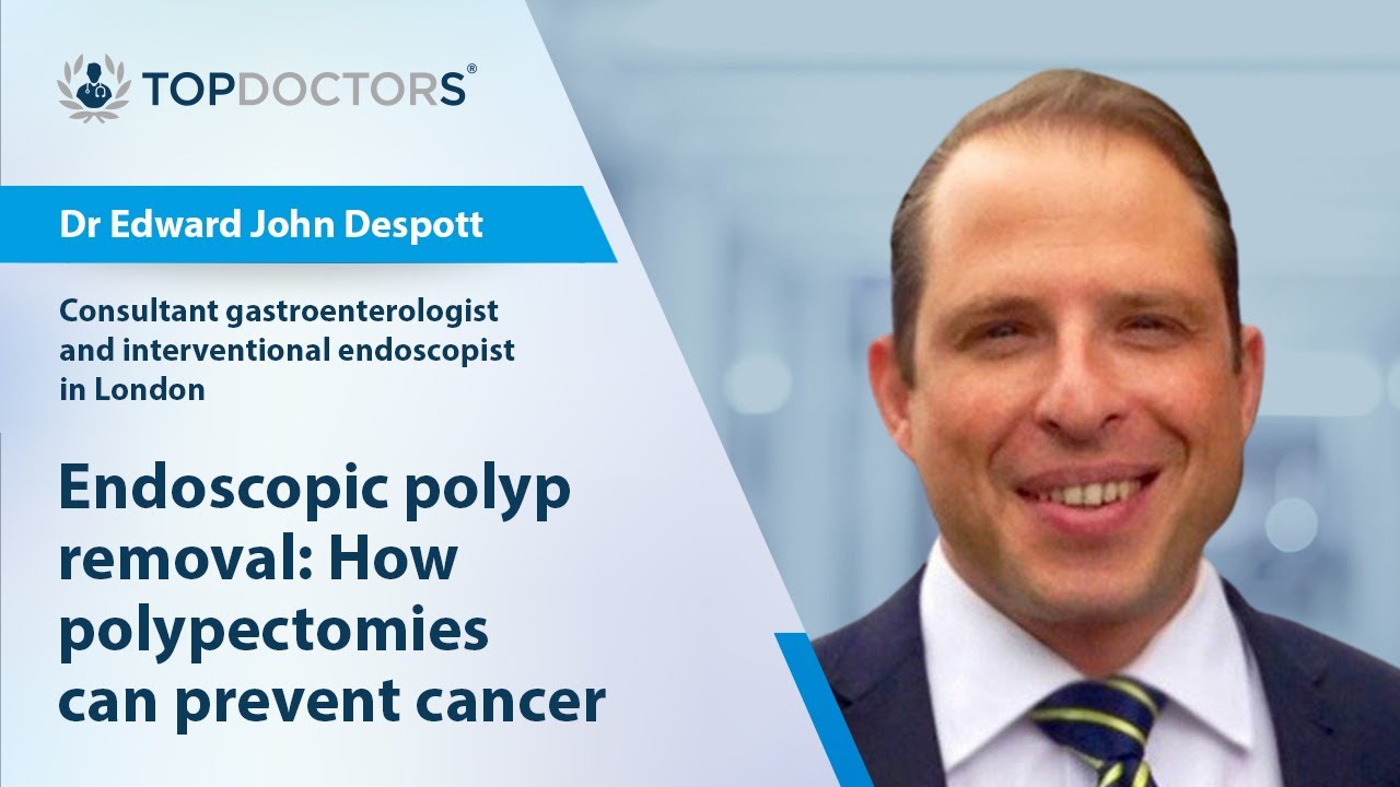 Endoscopic polyp removal - How polypectomies can prevent cancer ...