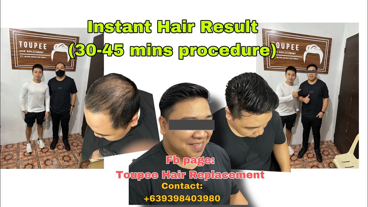 Toupee Hair Replacement - YouTube