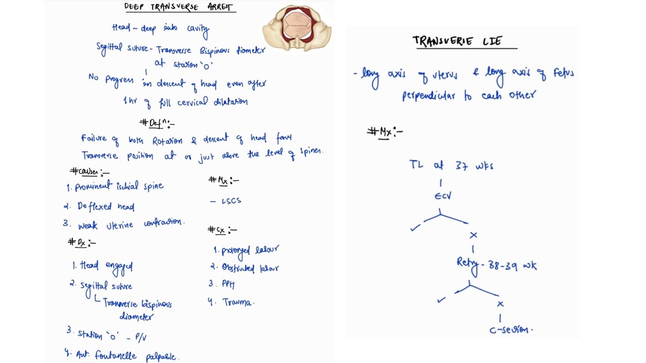 DEEP TRANSVERSE ARREST NOTES | TRANSVERSE LIE |OBSTETRICS | OBGY | ONE ...