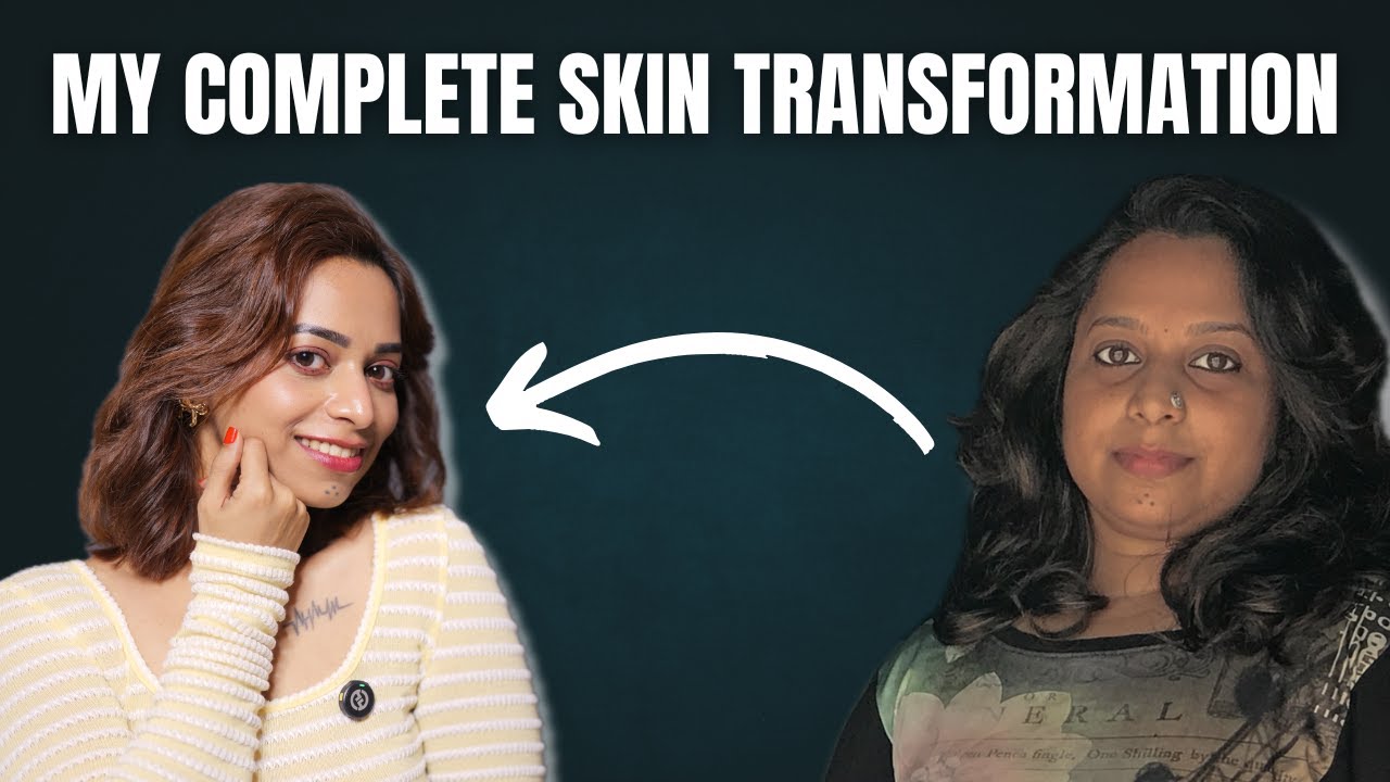 My Skin Transformation |Hyperpigmentation |Dark spots |Tanning |Dull ...