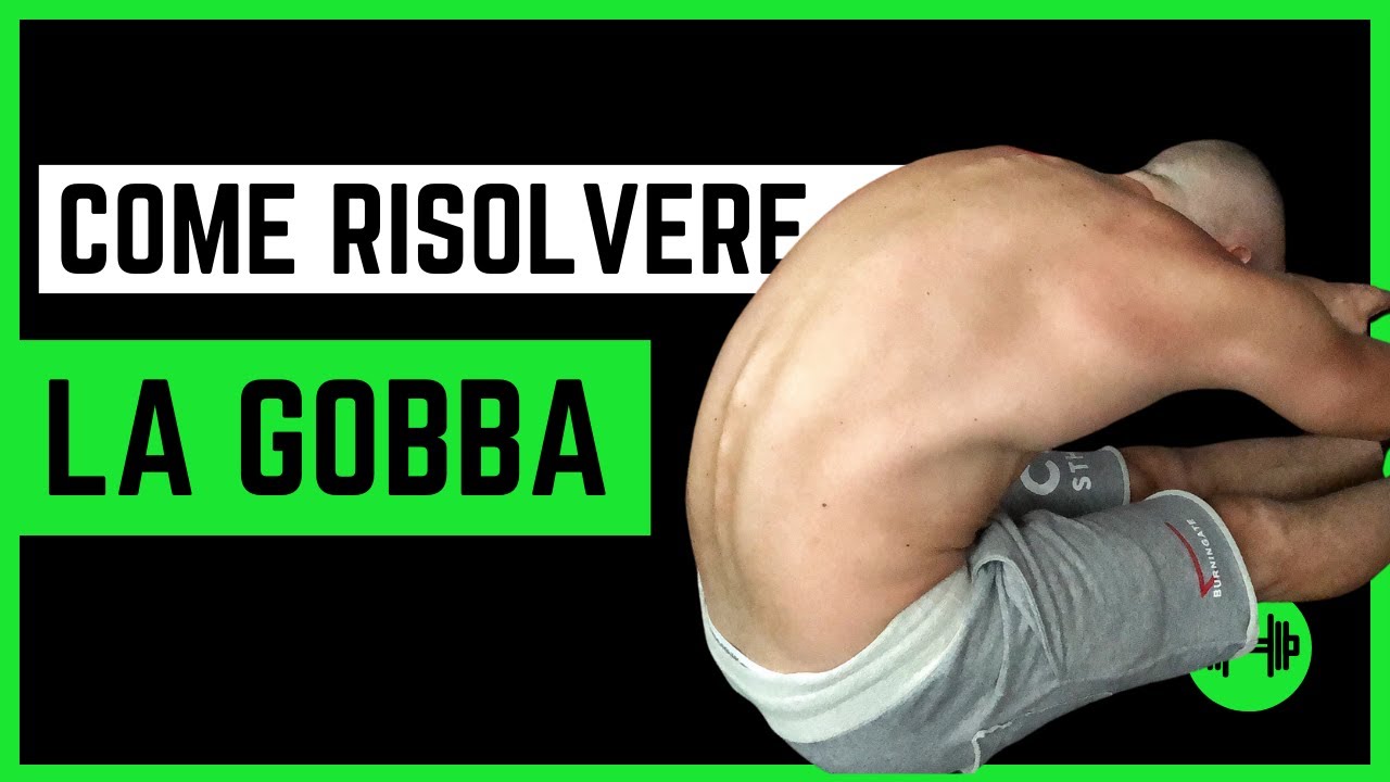Come risolvere la Gobba in modo veloce | Esercizi efficaci - YouTube