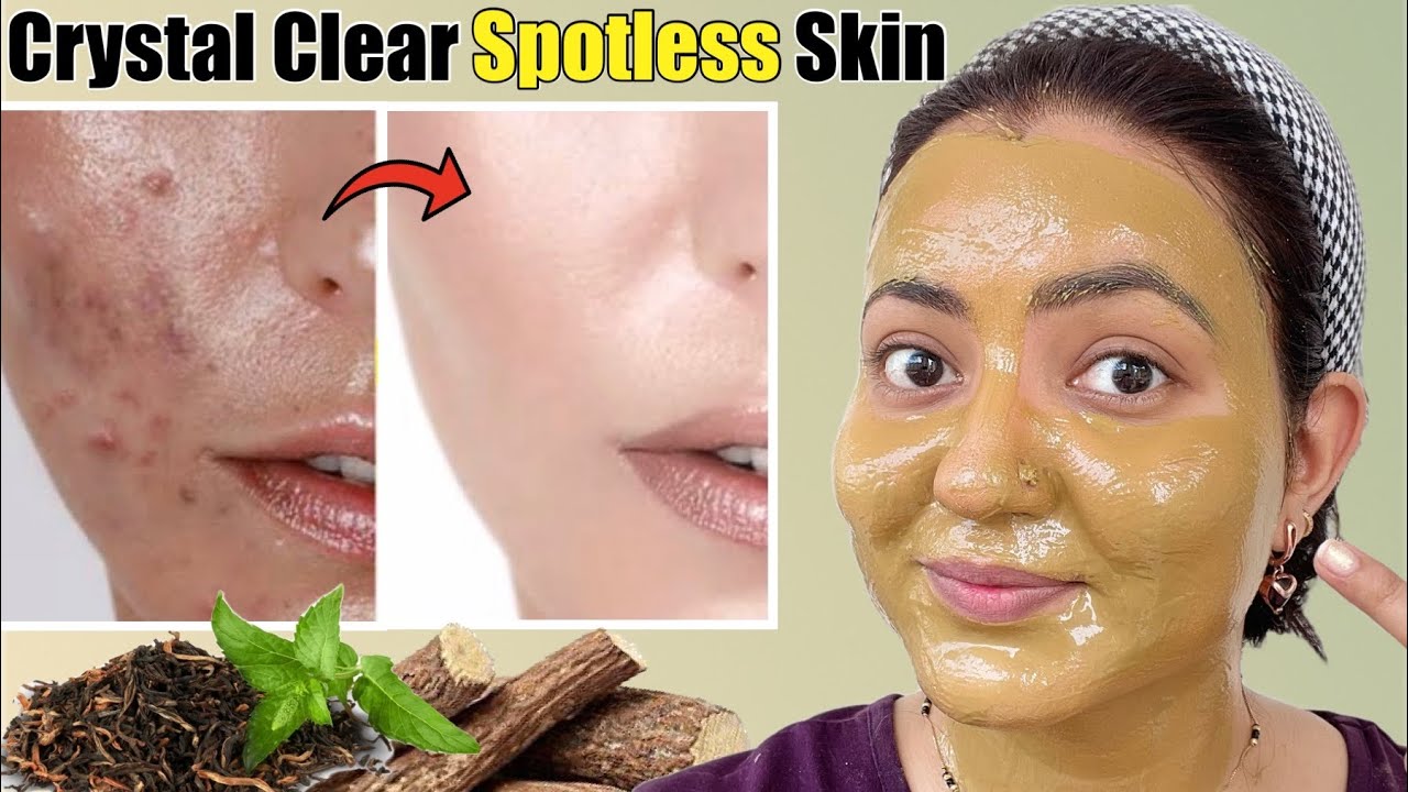 Winter Skin Transformation Challenge (Day 4):Remove Dark/Brown Spots ...