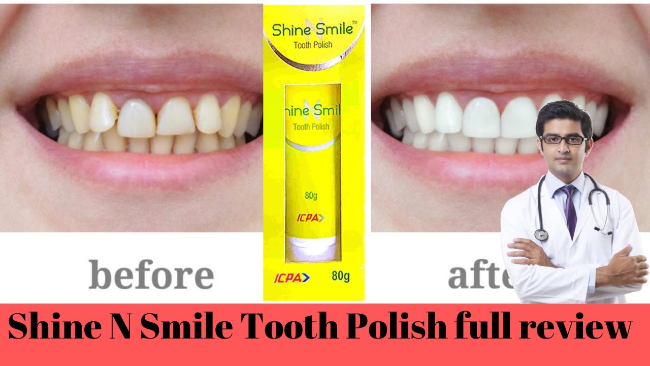 Shine N Smile Tooth Polish Review - Your Gateway to Dazzling ...