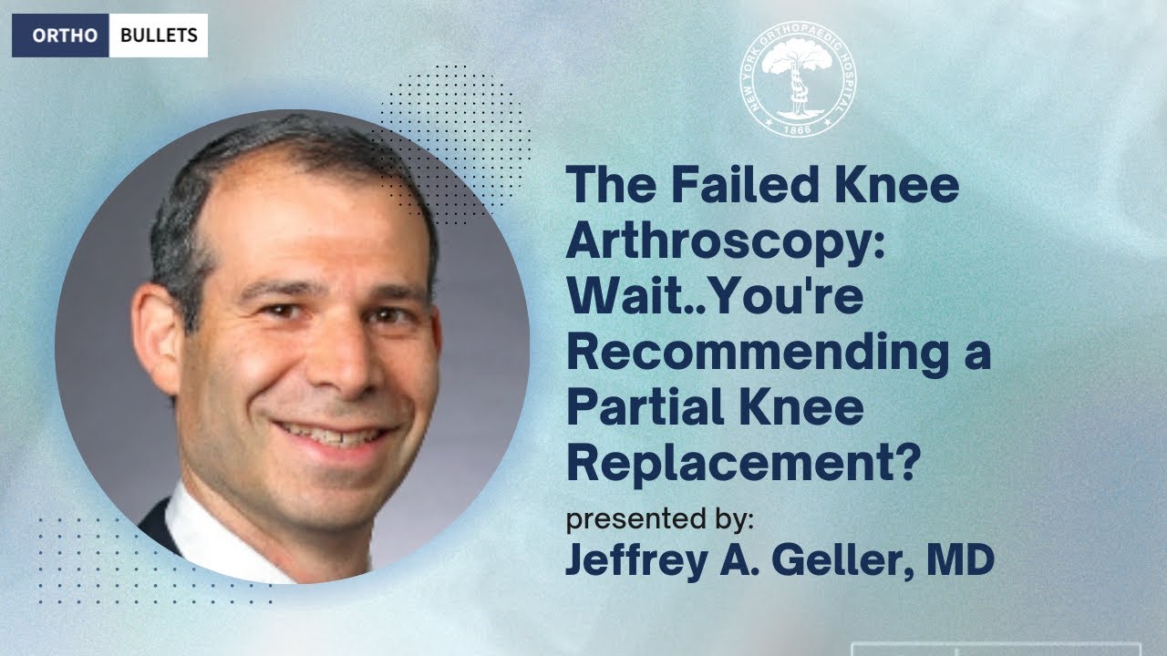 Failed Knee Arthroscopy: Wait You're Recommending a Partial Knee ...
