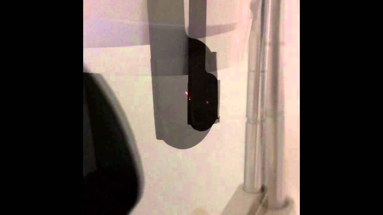 Láser multispot para enfermedades en la retina, rápido, eficiente y lo ...