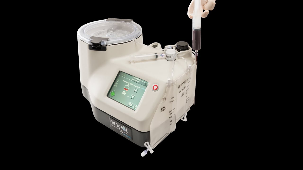 Cellular Components and Growth-Factor Content of PRP From the Angel ...