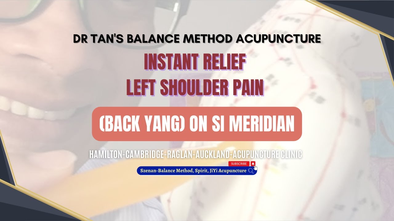 #33 Dr Tan's Balance Method Acupuncture Instant Relief Left Shoulder ...