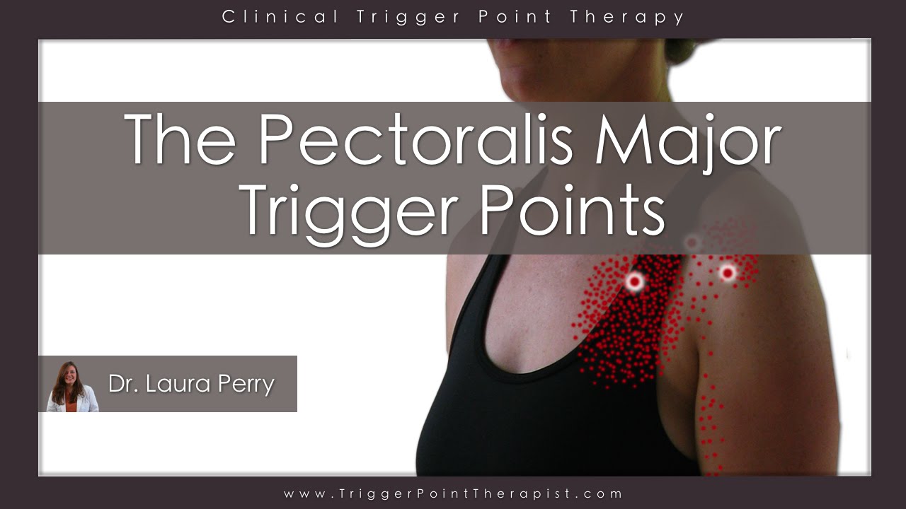 The Pectoralis Major Trigger Points - YouTube