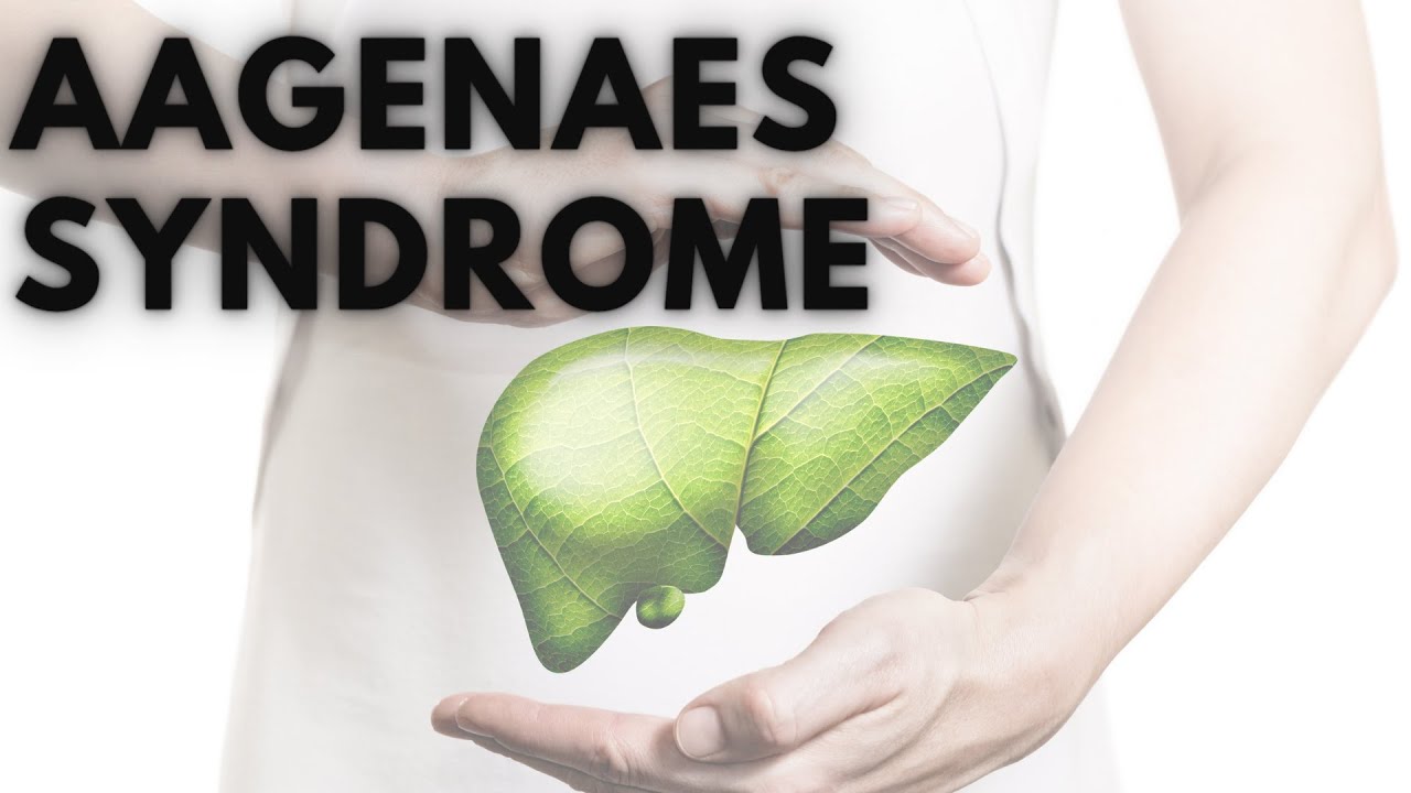 What is Aagenaes syndrome??? - YouTube