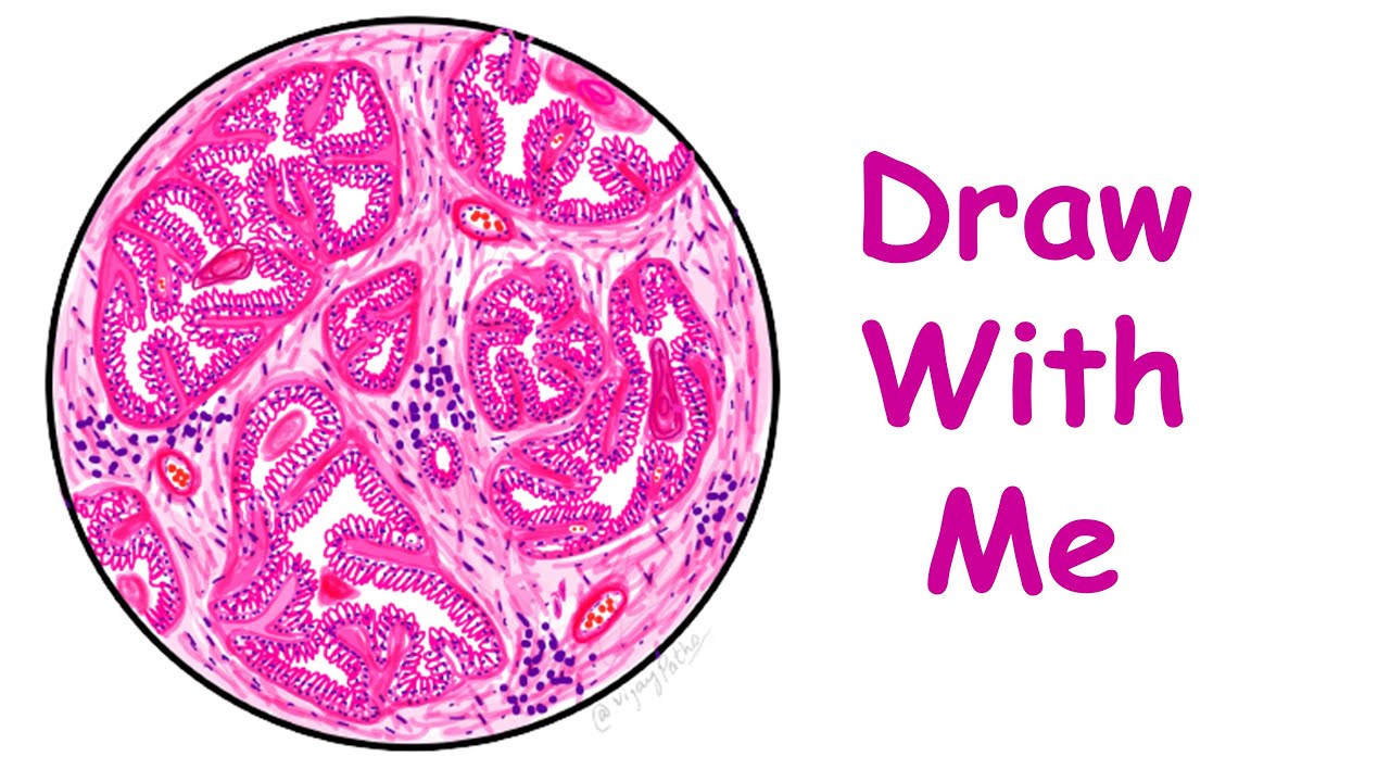 Benign Prostatic Hyperplasia- Draw with me! - YouTube