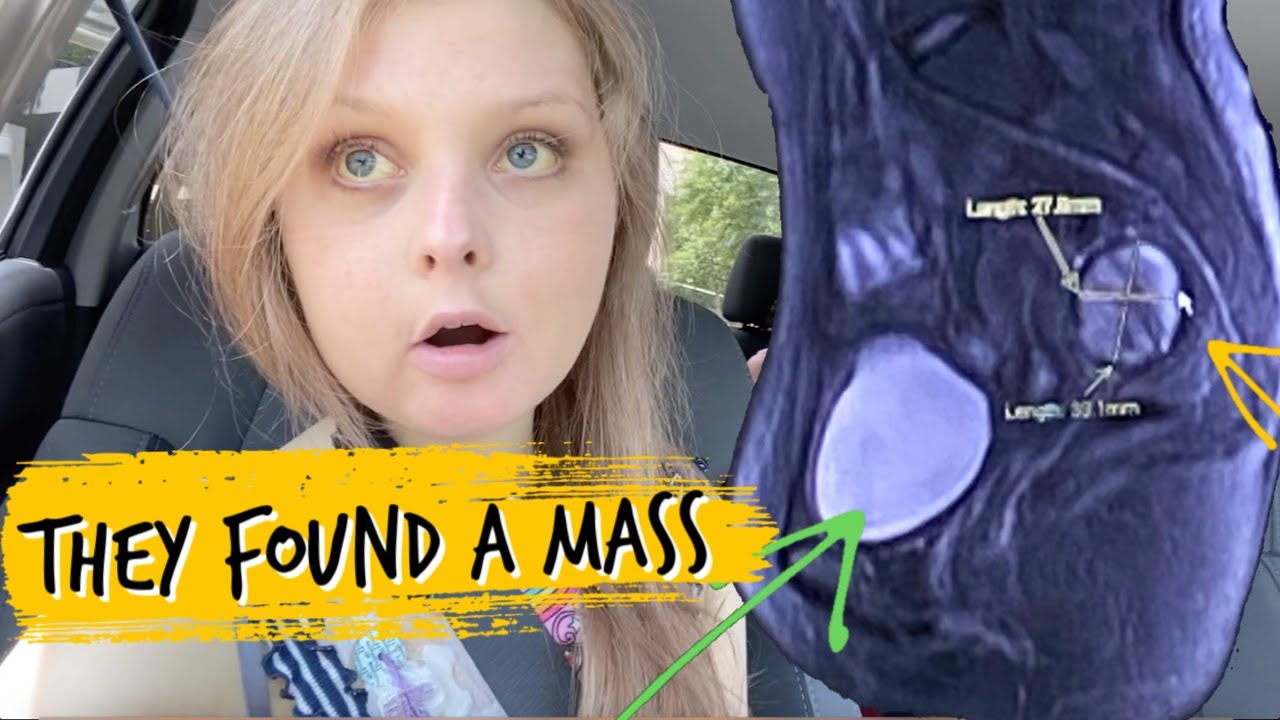 THE RESULTS ARE IN...ACCIDENTAL MRI FINDINGS - YouTube