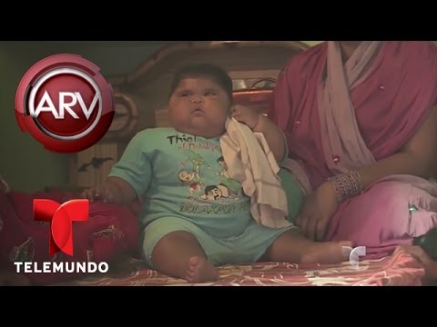Bebé obesa pesa más de 40 libras y tiene solo 10 meses | Al Rojo Vivo | Telemundo