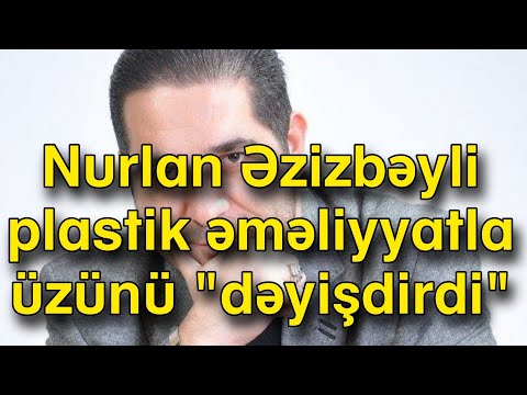 Nurlan Əzizbəyli plastik əməliyyatla üzünü \