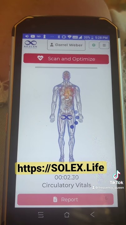 Solex Life AO Scan - Body Systems Scan 💥 Join Solex.Life team! #quantum #aoscan #solex #health # ...