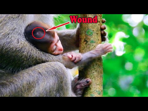 Million Pity! It Hard To See Poor Baby Monkey Head Wound Pain, She ...