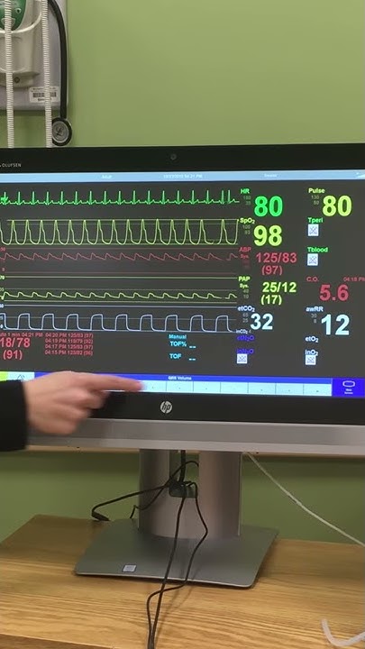 Virtual Lab: Monitor: G - YouTube